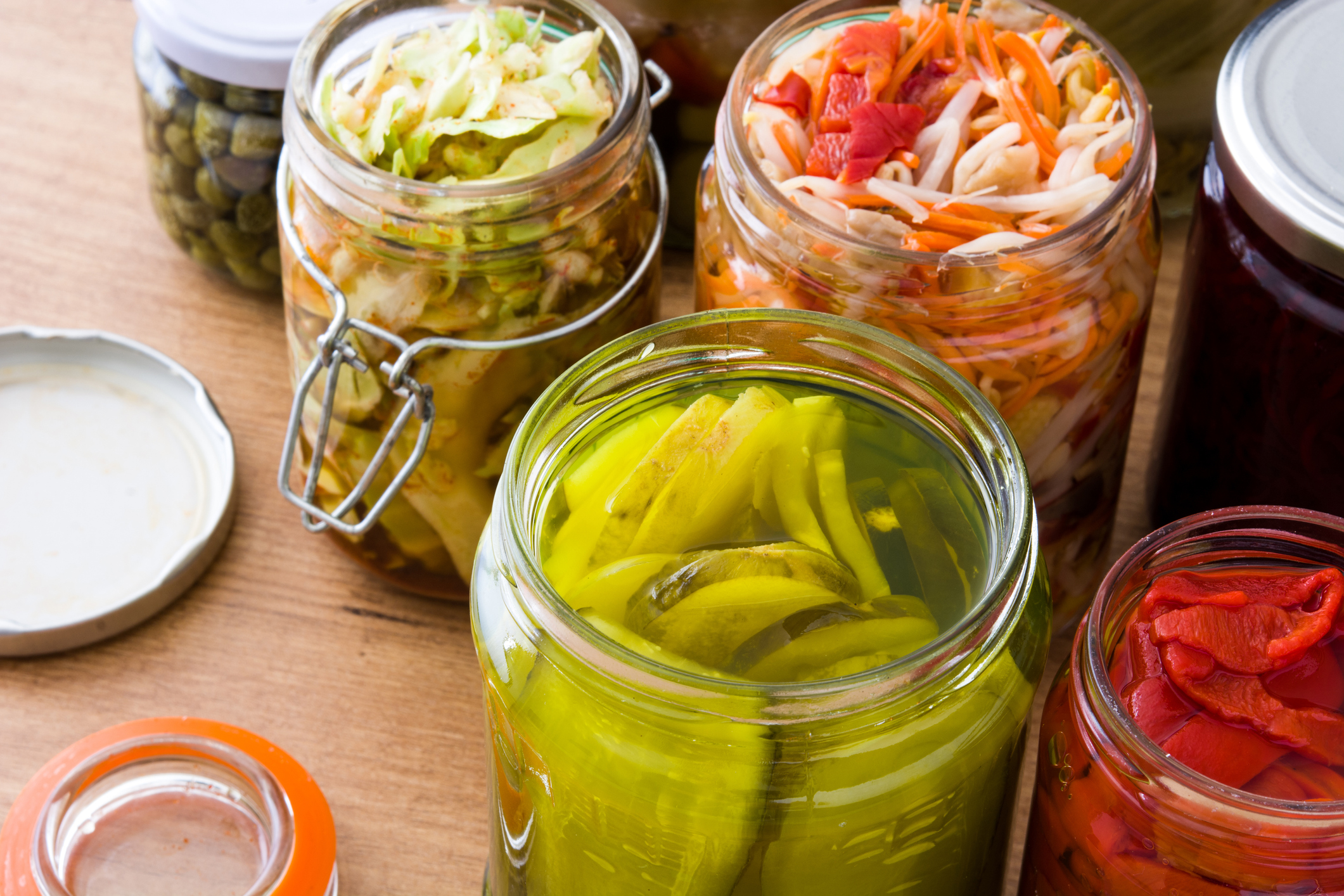 What Are Fermented Foods? | Mark’s Daily Apple – P-HealthX